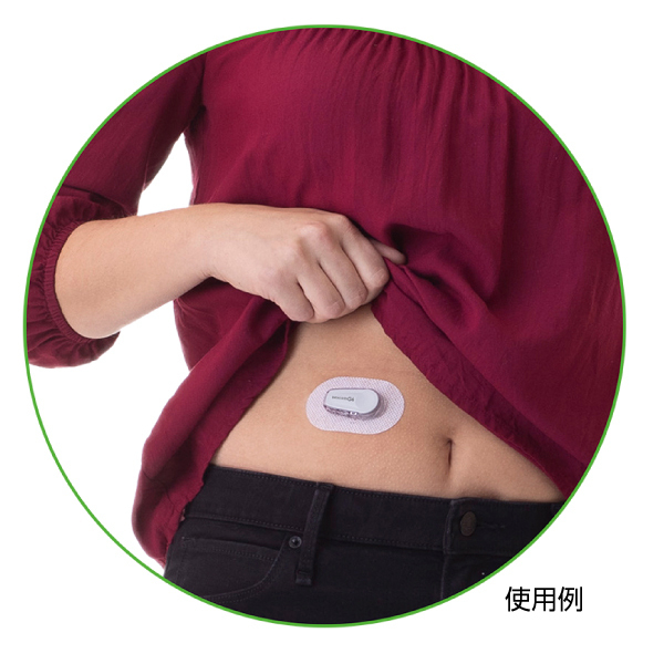 【MSGooDs】商品詳細：Dexcom G6 CGMシステム | 当日発送！ - 医療用品／医薬品／鍼灸用品等の通販